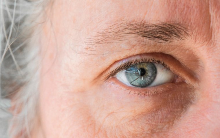 What Is Panuveitis? | OBN