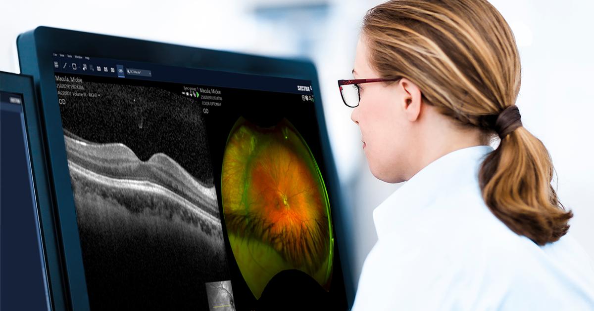 What is Ocular Inflammation and How to Manage it | OBN